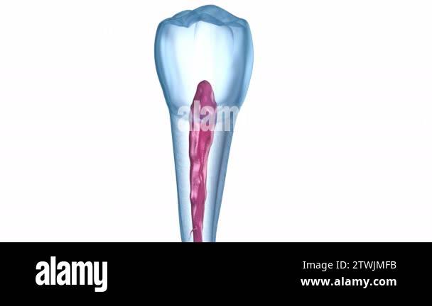 Dental root anatomy - Mandibular Second premolar tooth. Medically ...
