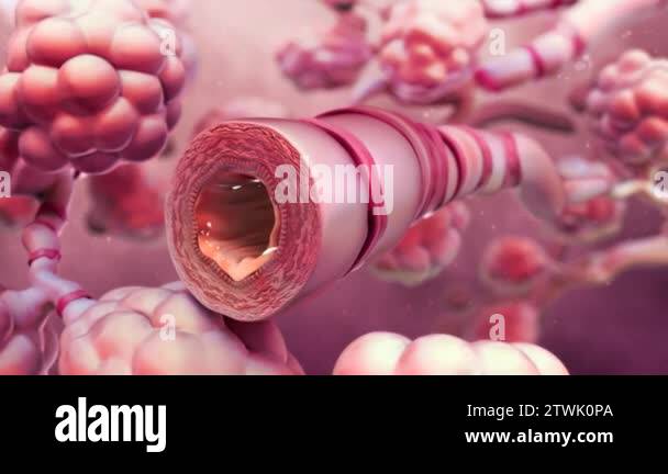 Bronchial hyperreactivity develops when the smooth muscle that ...