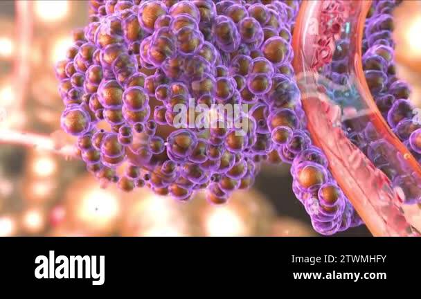 Tumor cells that fill blood with abnormal cells Stock Video Footage - Alamy