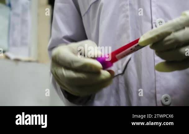 upside down tilting and inverting of blood sample tube to mix blood ...