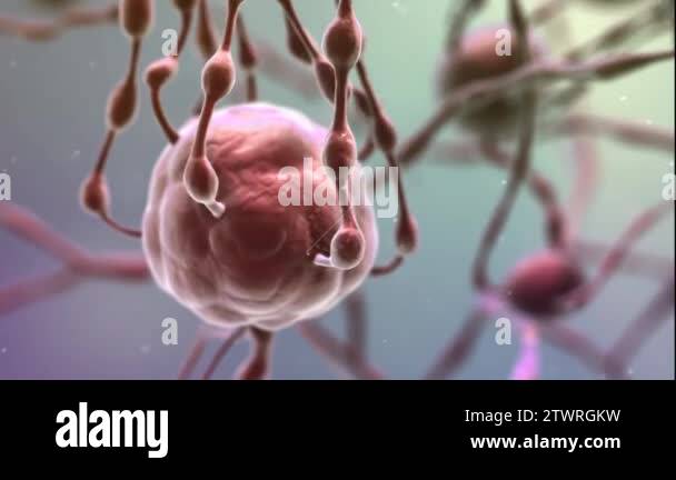 Tonsil gland cancer swollen Stock Videos & Footage - HD and 4K Video ...