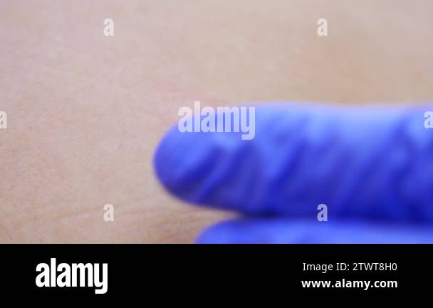 doctor dermatovenereologist makes an injection of anesthesia in the ...