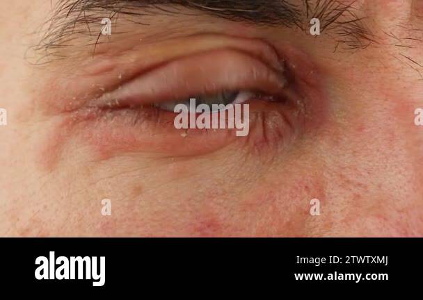 Right human eye Stock Videos & Footage - HD and 4K Video Clips - Alamy