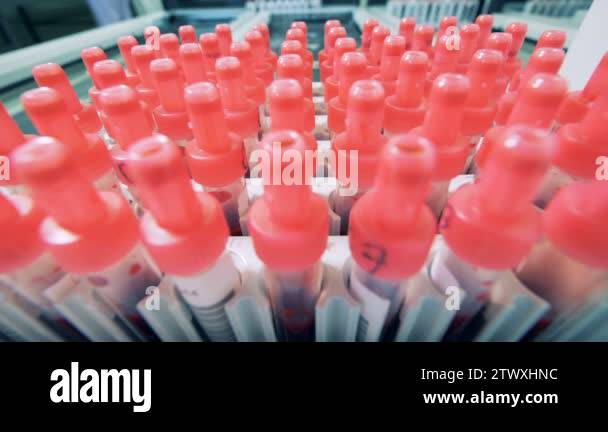 Blood plasma bottles Stock Videos & Footage - HD and 4K Video Clips - Alamy