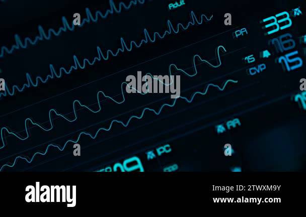 Multi-parameter patient monitor screen / Medical blue screen interface ...