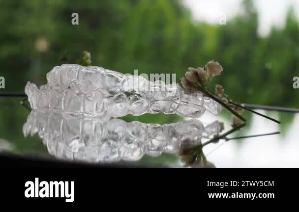 Invisible dental teeth brackets tooth aligners plastic braces dentistry ...