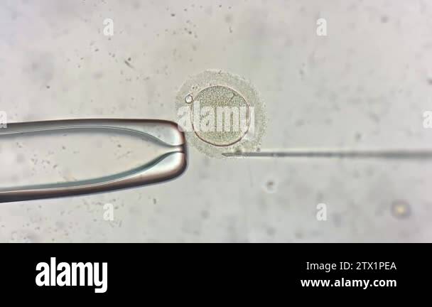 View through microscope at in vitro fertilization process Stock Video ...