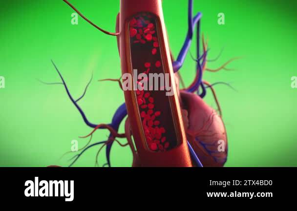 heart, Human heart model, Human Heart Anatomy, Artery, artery shown ...