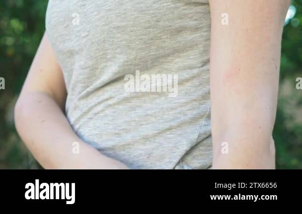 Scratch soft itchy red bumps on the skin from mosquito bites on hand ...