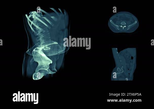 Abdominal anatomy side view Stock Videos & Footage - HD and 4K Video ...