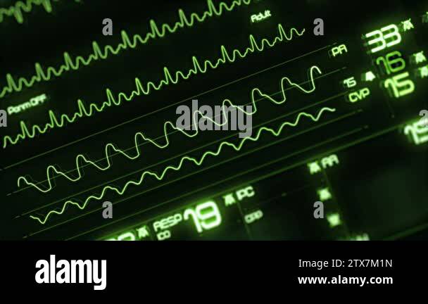 Multi-parameter patient monitor screen / Medical green screen interface ...
