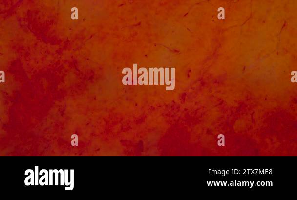 Introduction of Injection Intramuscularly. Inside view. The tip of the ...