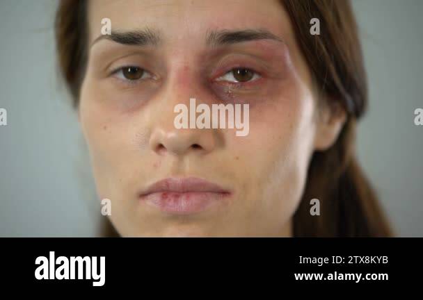 Hurt lady Stock Videos & Footage - HD and 4K Video Clips - Alamy