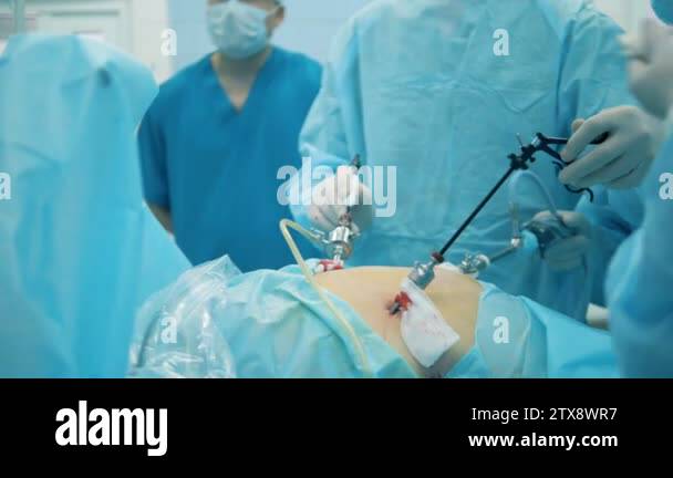 Team of surgeons are performing an operation on an abdominal cavity ...