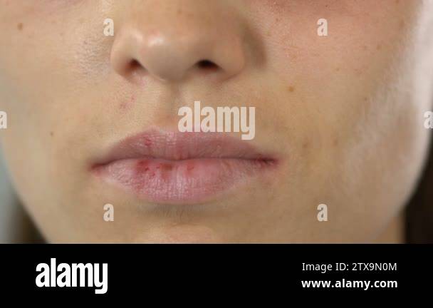 Helpless woman bruised face crying, domestic violence victim, abuse ...