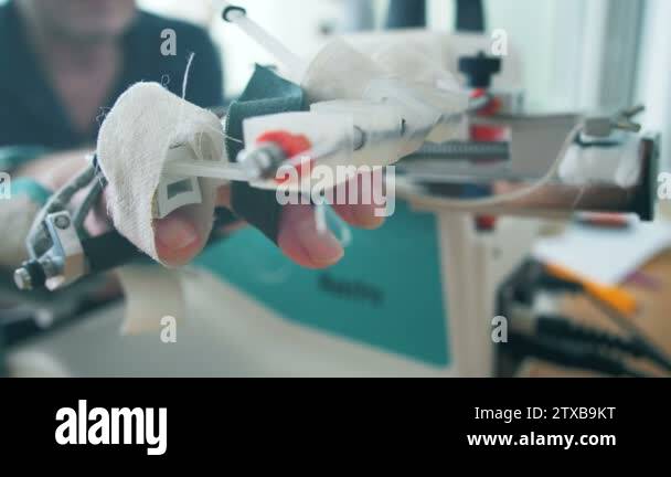 Fingers of a male patient are getting lowered and bent by a medical ...