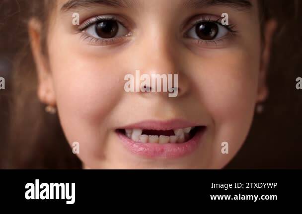 Baby teeth. Toothless smile. Cutting root tooth. The girl opens her ...