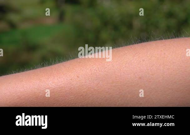 CLOSE UP MACRO DEPTH OF FIELD: Detail of skin and hair with goose bumps ...