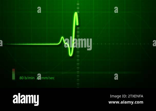 Ekg electrocardiogram Stock Videos & Footage - HD and 4K Video Clips ...