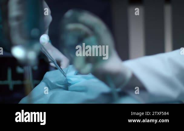 Operation anesthetic mask Stock Videos & Footage - HD and 4K Video ...