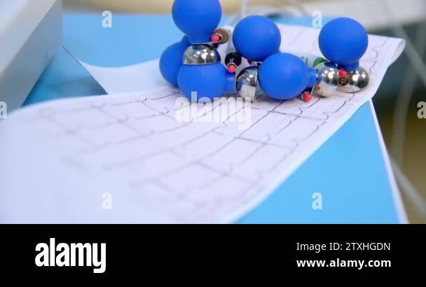 Close up graph printout from ecg machine during girl patient lying on ...