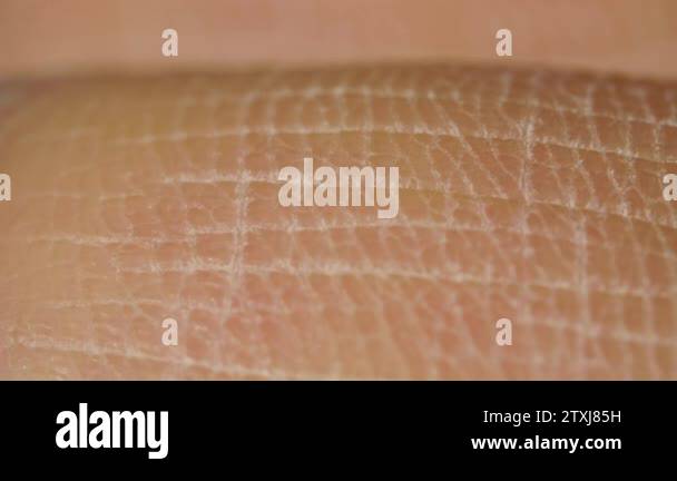 White detailed caucasian human skin on hand fingers closeup in macro ...