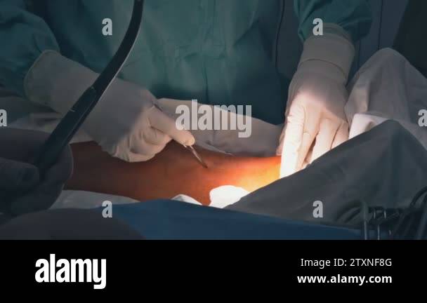 Patient with a cutting our incision a deeper human leg with bloody scar ...