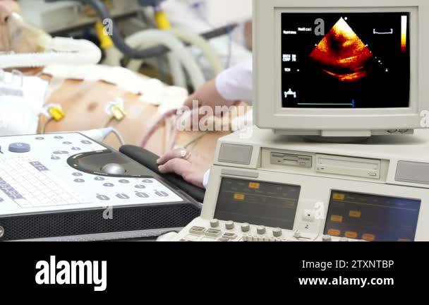Ultrasonic imaging Stock Videos & Footage - HD and 4K Video Clips - Alamy