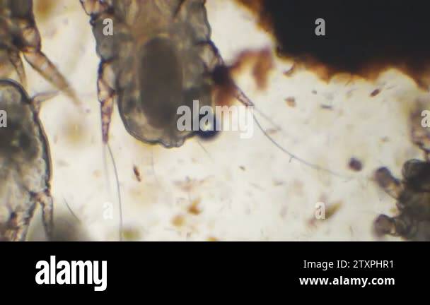 Veterinary Medicine Ear swab of a cat's ear revealing heavy ear mite ...