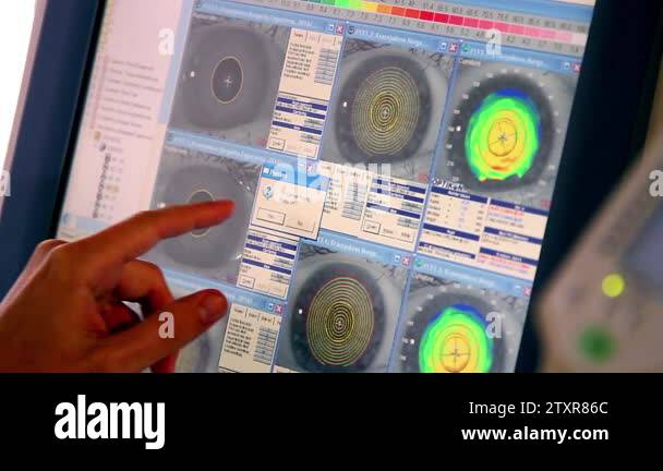 doctor holds the patient eye exam and watching the result on the ...