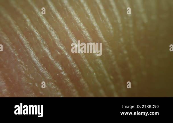 Skin ridges Stock Videos & Footage - HD and 4K Video Clips - Alamy