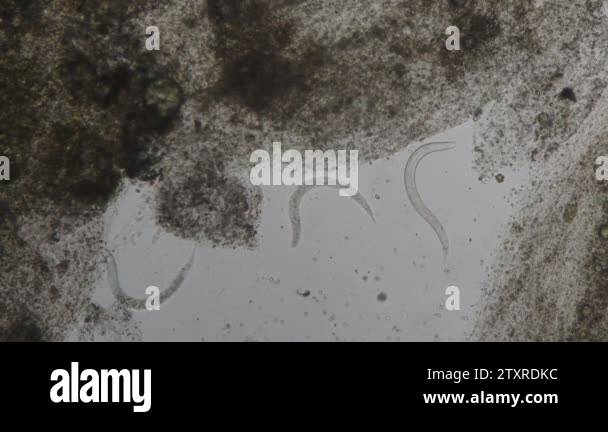 parasite : Strongyloides stercoralis from human feces under microscope ...