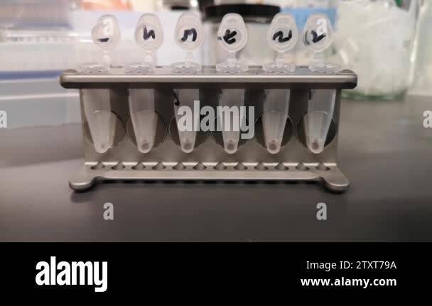 DNA purification with magnetic beads. Tubes in a magnetic rack, taking ...
