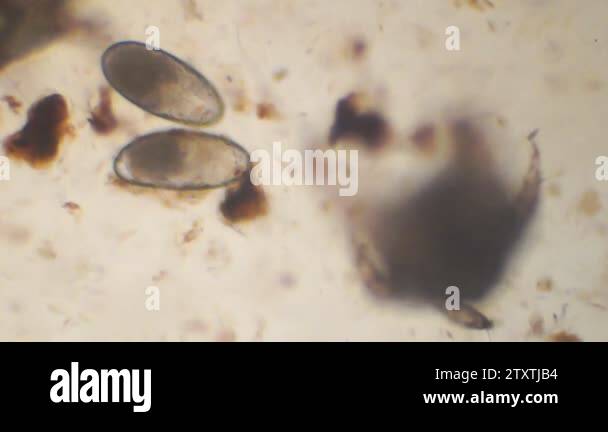 Veterinary Medicine Ear swab of a cat's ear revealing heavy ear mite ...
