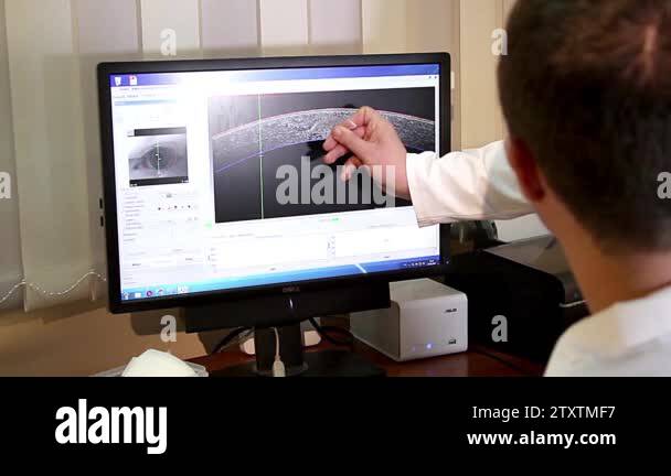 corneal wavefront analysis, Scanning the retina, Unrecognizable young ...