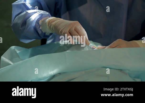 doctor hands on the ophthalmic operating, The operation on the eye ...