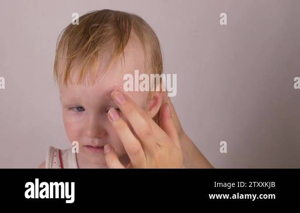 Mother treats a scar wound on the forehead of her little caucasian ...