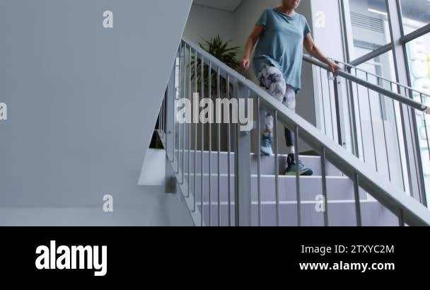 Front view of a Caucasian female patient with a prosthetic leg walking ...