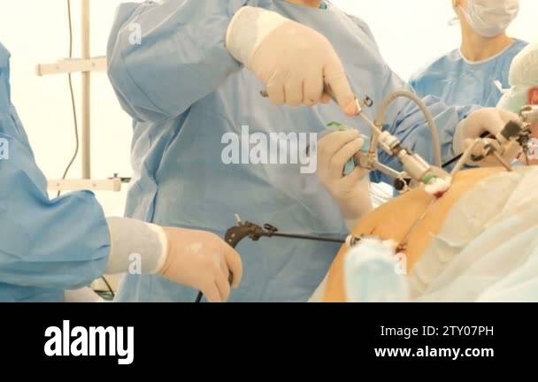 Surgical endoscopic laparoscopy. Camera movement from top to bottom ...