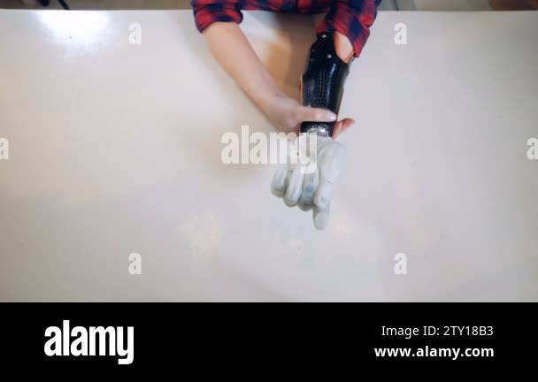 Woman one arm amputee Stock Videos & Footage - HD and 4K Video Clips ...