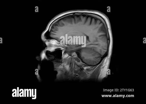 Brain MRI, head scans and tumor detection. Diagnostic medical tool ...