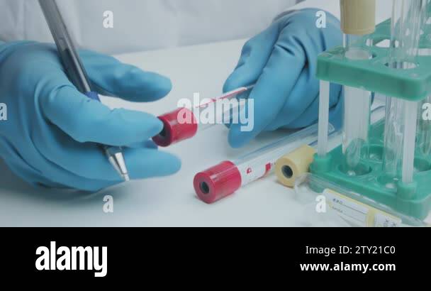 Laboratory assistant signs pen test tubes to collect analysis and ...