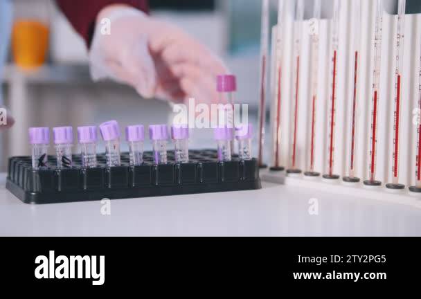 Medical clinic. Nurse put a stand with test tubes near the pipettes ...
