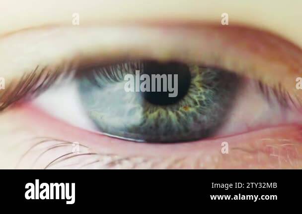 Macro View of Pupil Constriction Process in Human Eye. Constriction of ...