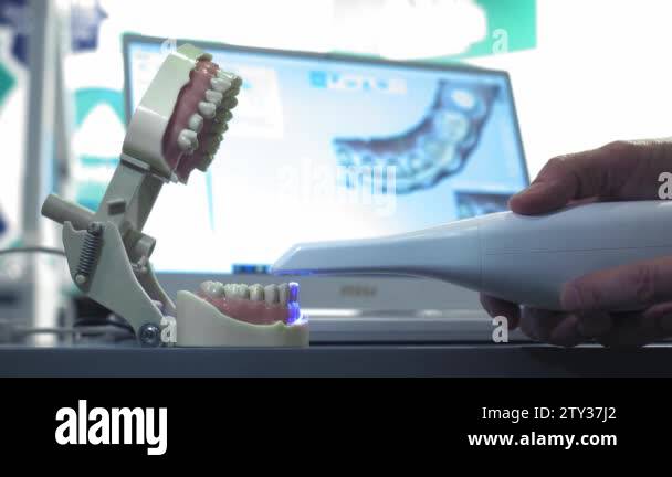 Manual 3D scanner for teeth. The doctor scans a cast of teeth on the ...