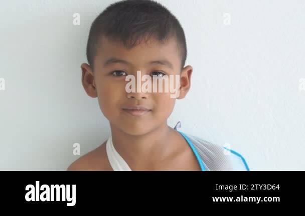 Cute boy hand bone broken from accident with arm splint Stock Video ...