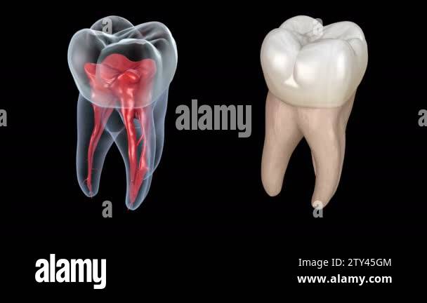 Dental root anatomy - First maxillary molar tooth. Medically accurate ...