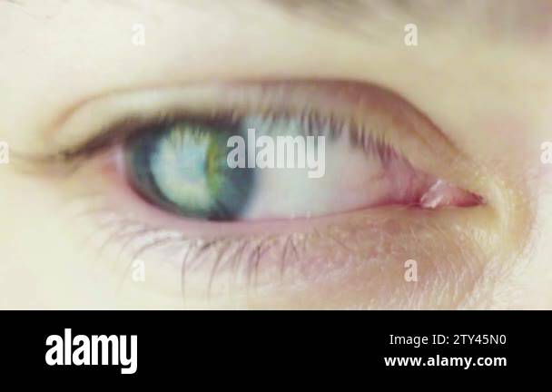 Beautiful Blue Eye of Young Woman Looking Around and Blinking. Pupil ...
