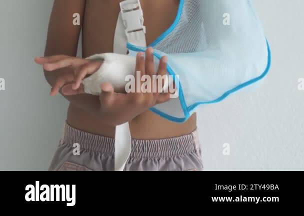 Cute boy hand bone broken from accident with arm splint Stock Video ...