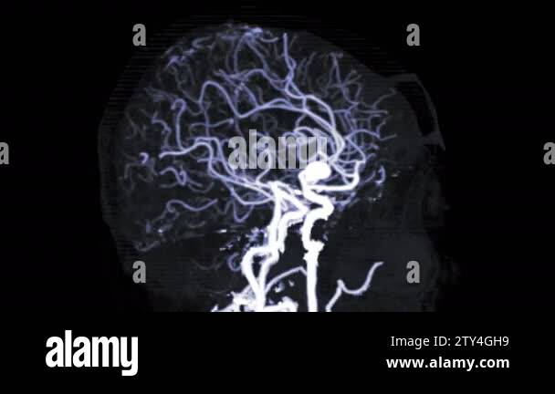 Acom Stock Videos & Footage - HD and 4K Video Clips - Alamy